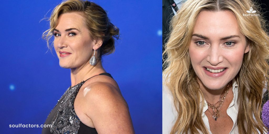 Celebrities Who Have Had a Thread Lift: 10 Big Names In HLWD