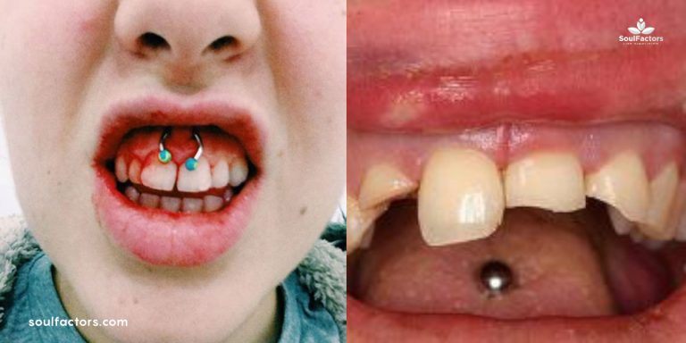 Smiley Piercing: A Fashion Forward Statement!