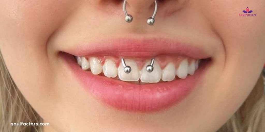 Smiley Piercing: A Fashion Forward Statement!