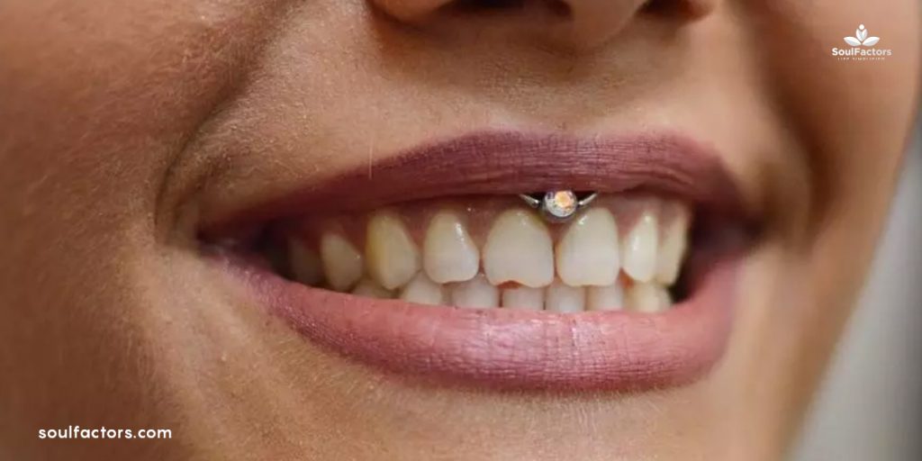 Smiley Piercing: A Fashion Forward Statement!