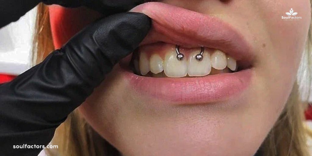Smiley Piercing: A Fashion Forward Statement!